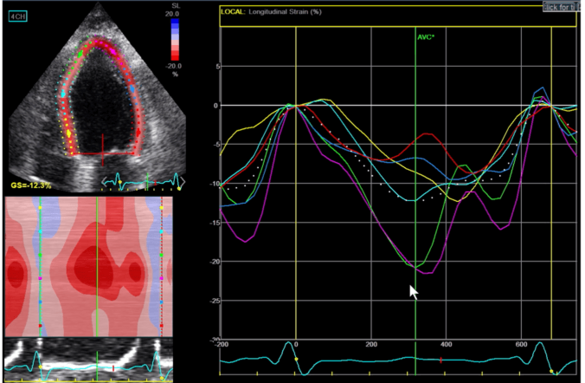 Kreiskrankenhaus Bergstraße: Echokardiographielabor